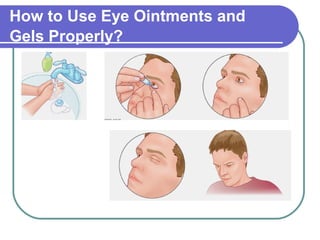 Ophthalmic preparations2 | PPT