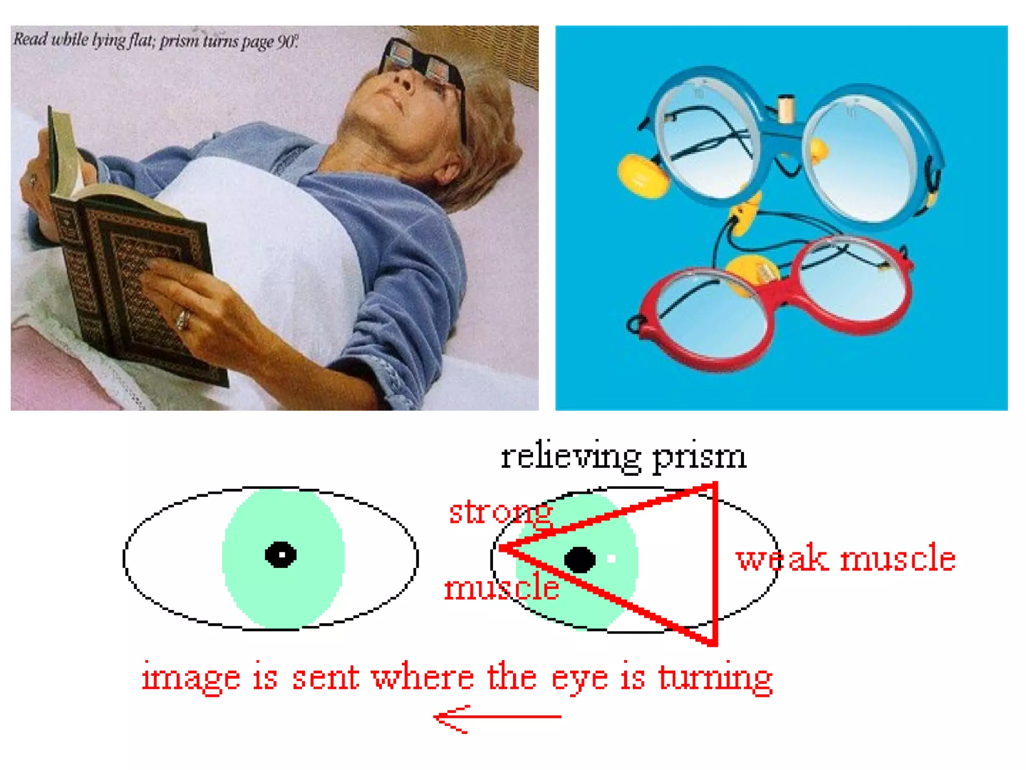Ophthalmic prism | PPT
