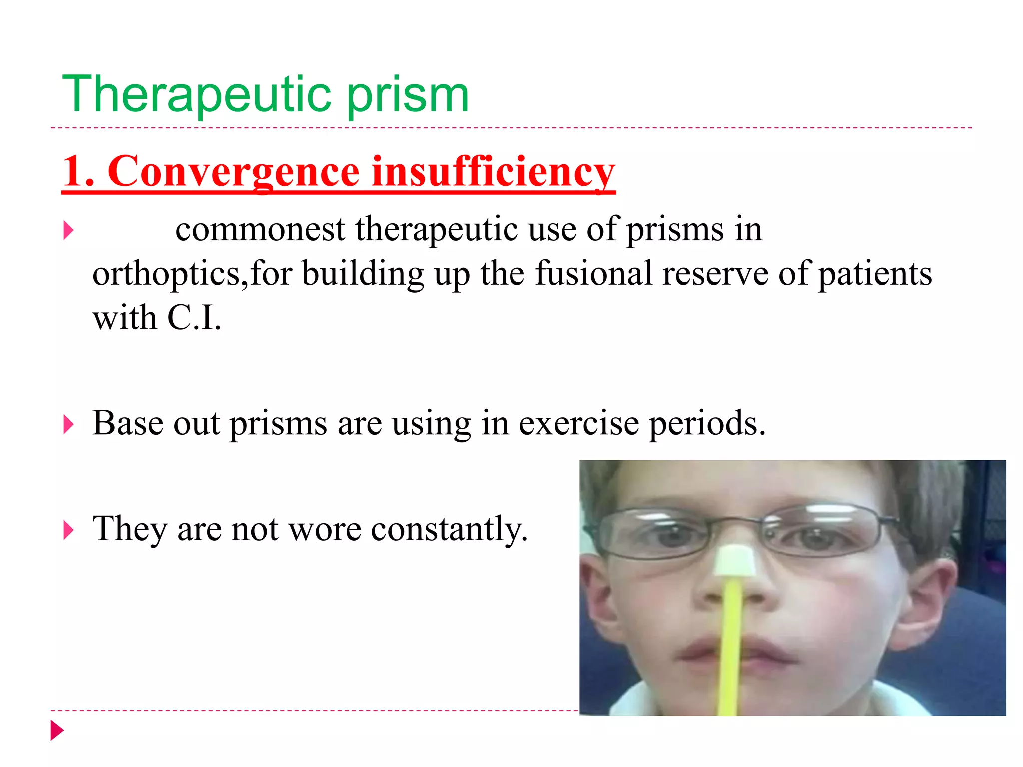 Ophthalmic prisms | PPTX