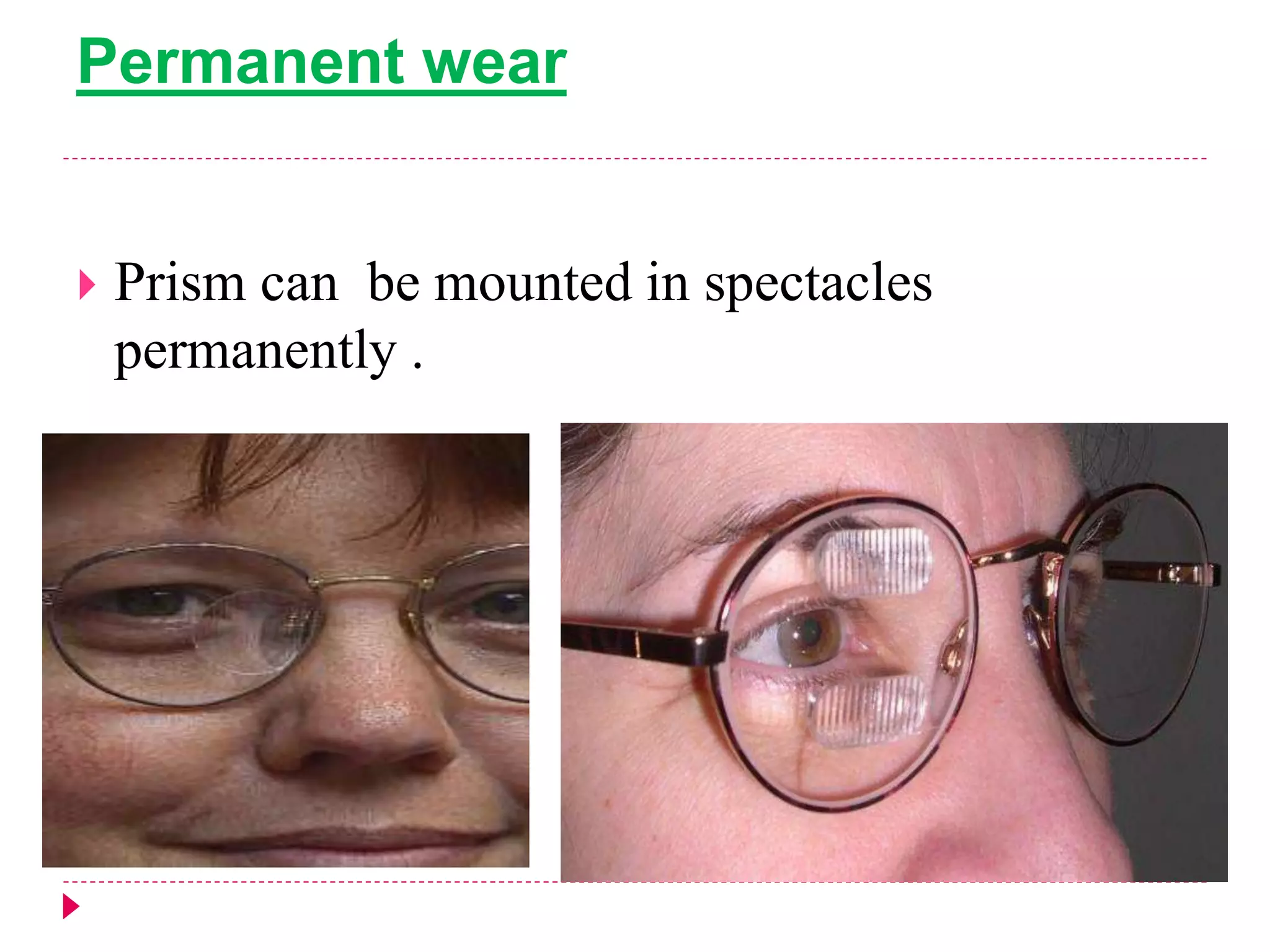 Ophthalmic prisms | PPTX