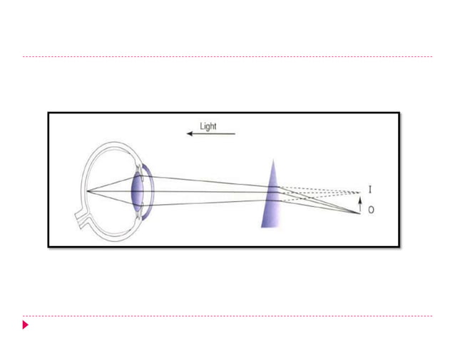 Ophthalmic prisms | PPTX