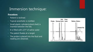 Ophthalmic ultrasonography | PPTX