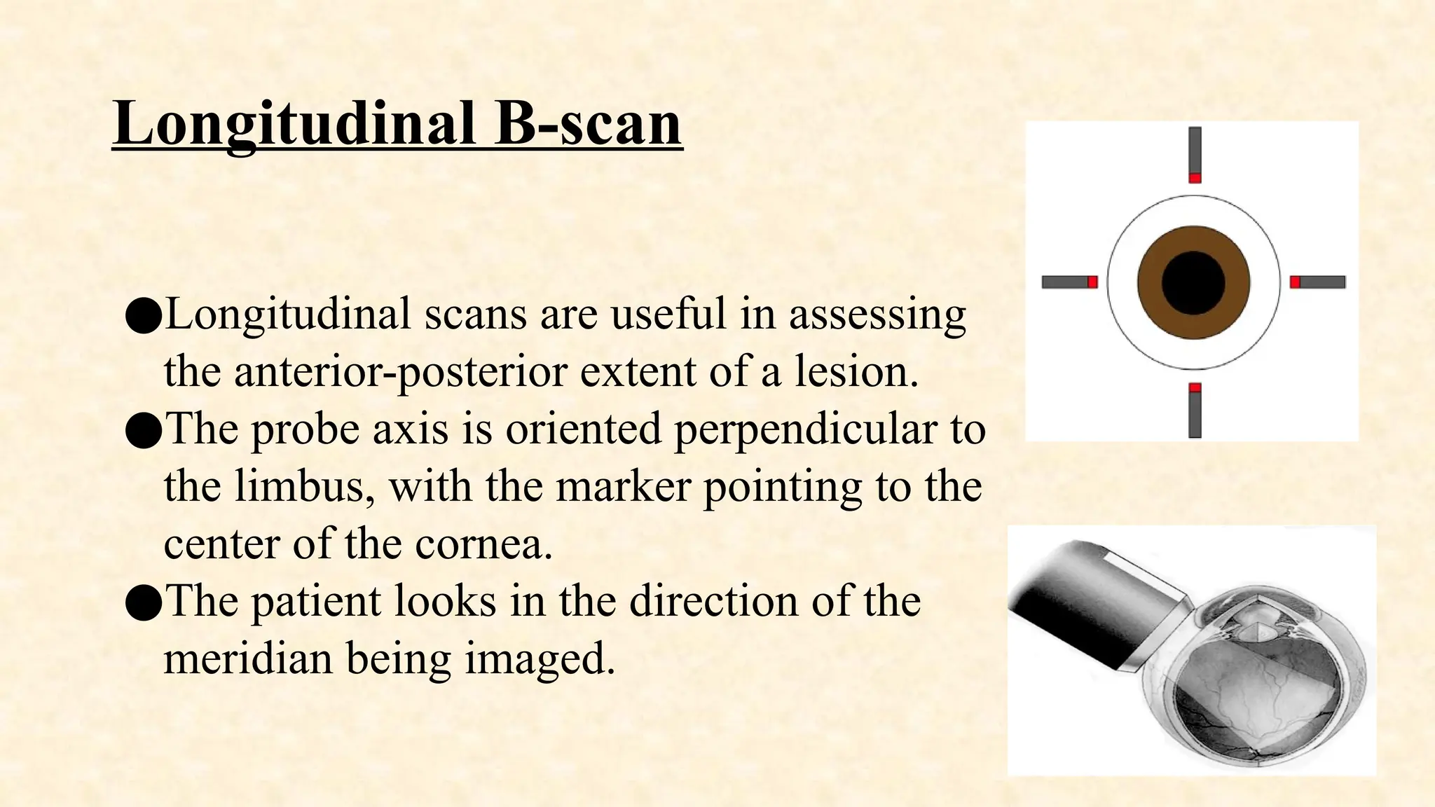 Ophthalmic Ultrasonography: How to Perform and Interpret | PPTX