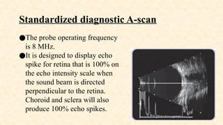 Ophthalmic Ultrasonography: How to Perform and Interpret | PPTX