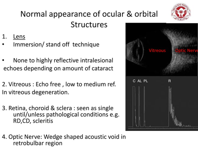 A quick guide to Ophthalmic Ultrasound/ B-Scan interpretation | PPTX