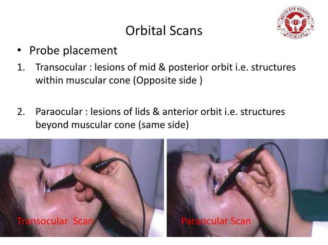 A quick guide to Ophthalmic Ultrasound/ B-Scan interpretation | PPTX