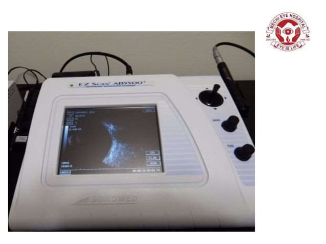 A quick guide to Ophthalmic Ultrasound/ B-Scan interpretation | PPTX