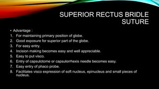 Ophthalmic viscosurgical devices | PPTX