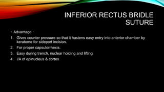 Ophthalmic viscosurgical devices | PPTX