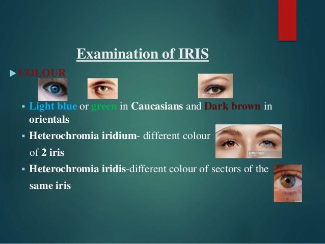 Ophthalmology sheet
