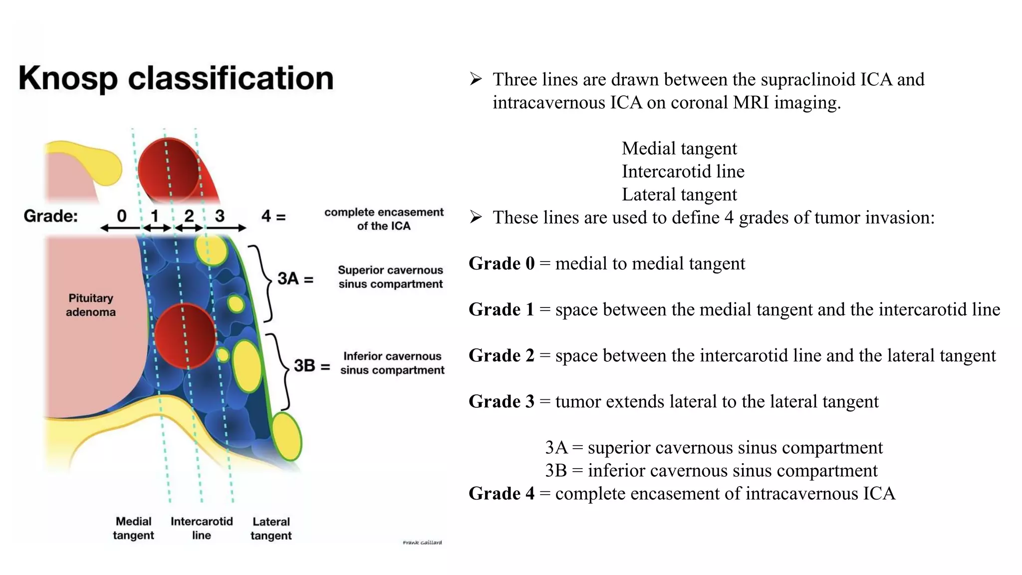 Ophthalmological evalution in sellar suprasellar tumours | PPTX