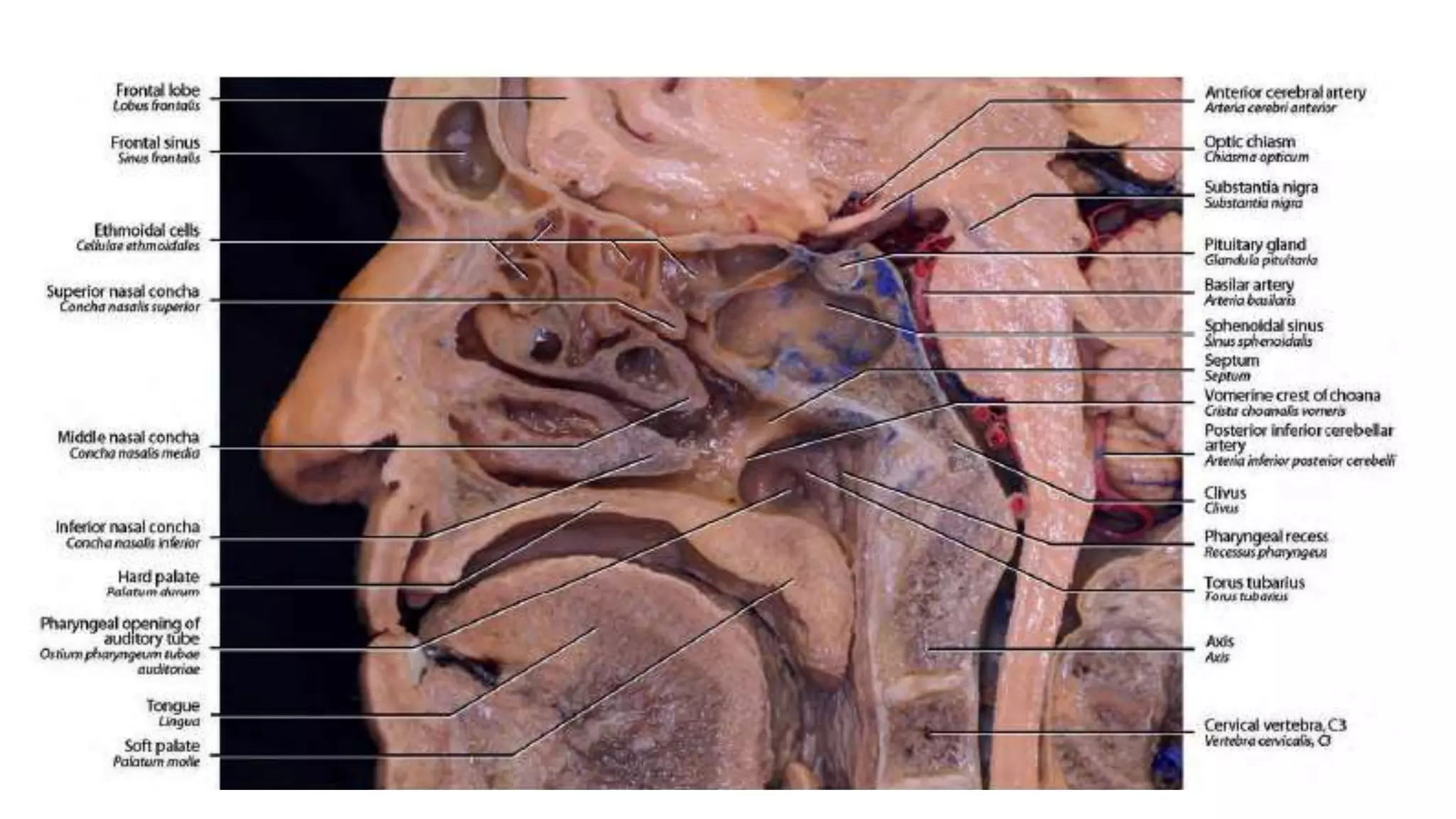 Ophthalmological evalution in sellar suprasellar tumours | PPTX