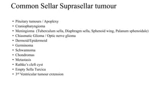 Ophthalmological evalution in sellar suprasellar tumours | PPT