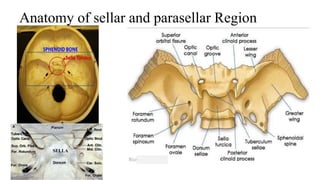 Ophthalmological evalution in sellar suprasellar tumours | PPT