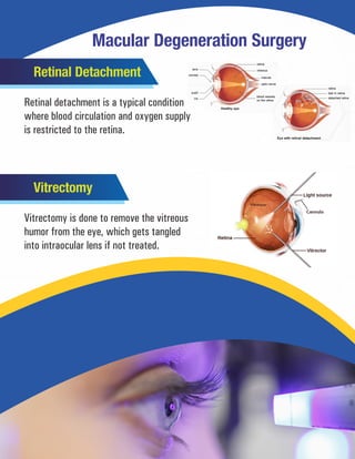 Ophthalmology Procedures List | Ophthalmic Surgical Procedures Pdf | PDF