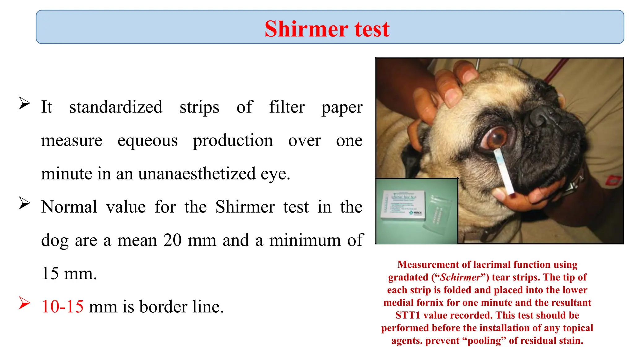 Ophthalmology of eye examination presentation | PPTX
