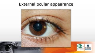 ophthalmology-v-eye-anatomy-and-function.pdf