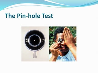 Ophthalmology and Ophthalmic nursing.pptx