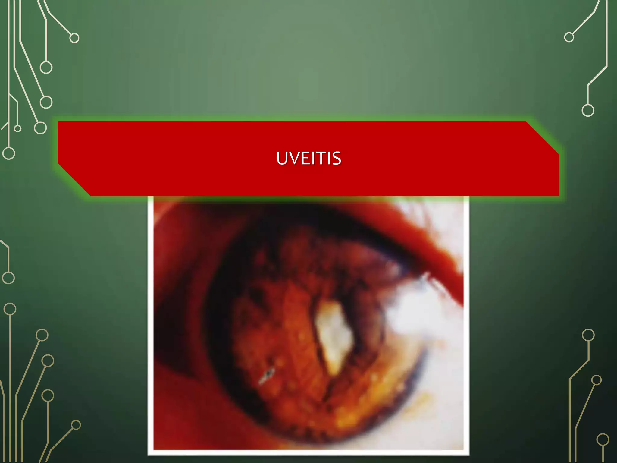 (Ophthalmology) ant. and post. uveitis, in english by dr. kalimullah ...