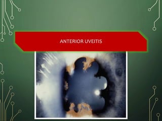 (Ophthalmology) ant. and post. uveitis, in english by dr. kalimullah ...