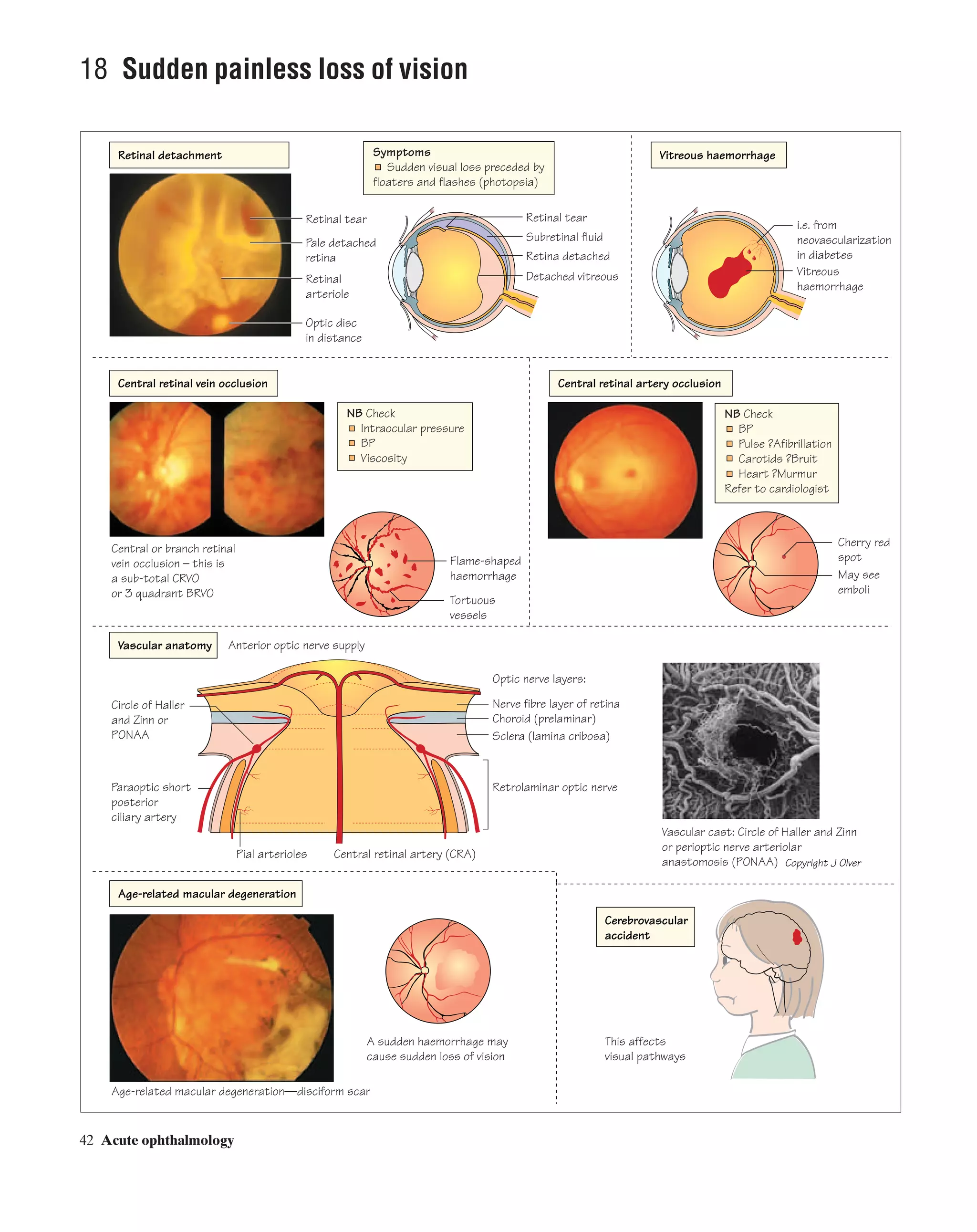 Ophthalmology at a Glance.pdf | Eye and Vision Conditions | Diseases ...
