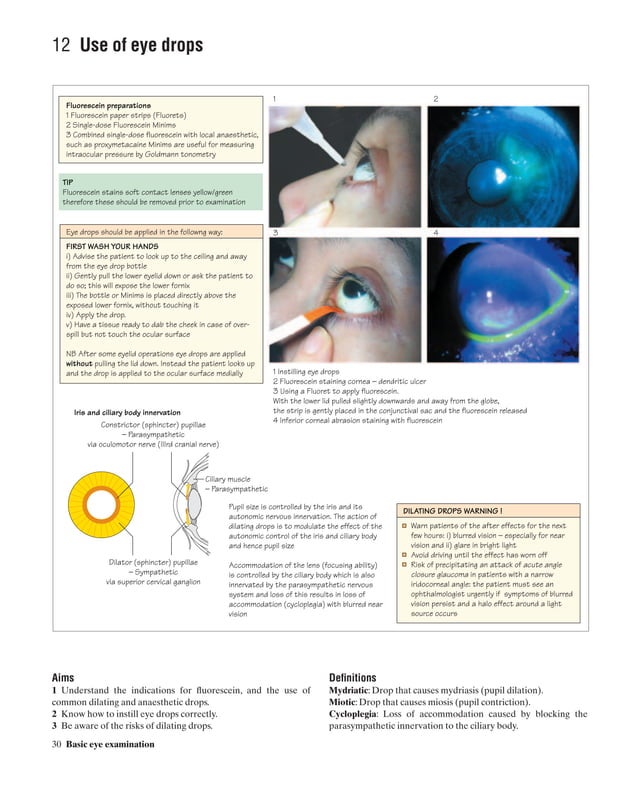 Ophthalmology at a Glance.pdf | Eye and Vision Conditions | Diseases ...