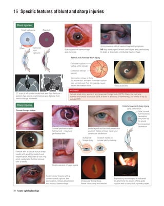Ophthalmology at a Glance.pdf