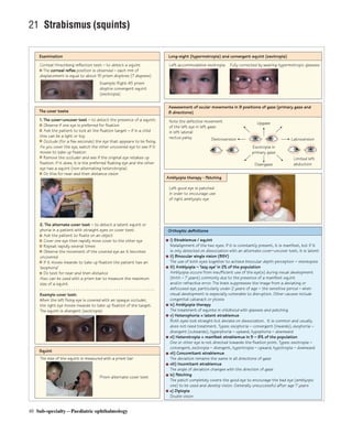 Ophthalmology at a Glance.pdf