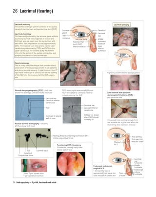 Ophthalmology at a Glance.pdf
