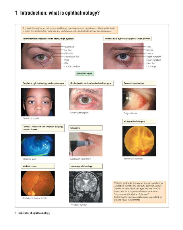 Ophthalmology at a Glance.pdf | Eye and Vision Conditions | Diseases ...