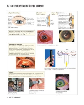 Ophthalmology at a Glance............pdf