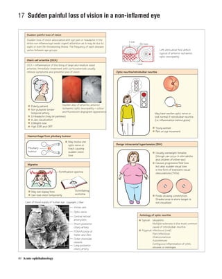 Ophthalmology at a Glance............pdf