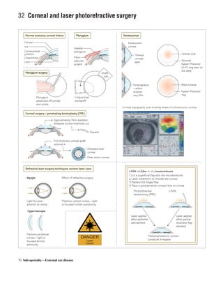 Ophthalmology at a Glance............pdf