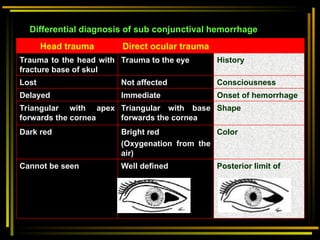 Ophthalmologyblunt ocular truma lecture.ppt