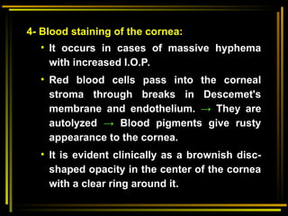 Ophthalmologyblunt ocular truma lecture.ppt