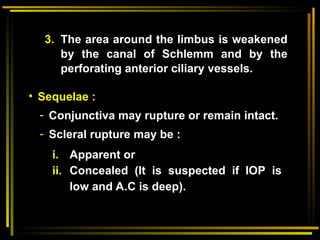 Ophthalmologyblunt ocular truma lecture.ppt