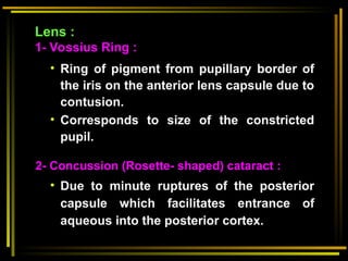 Ophthalmologyblunt ocular truma lecture.ppt