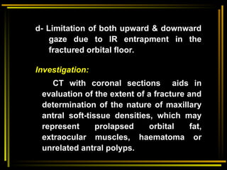 Ophthalmologyblunt ocular truma lecture.ppt
