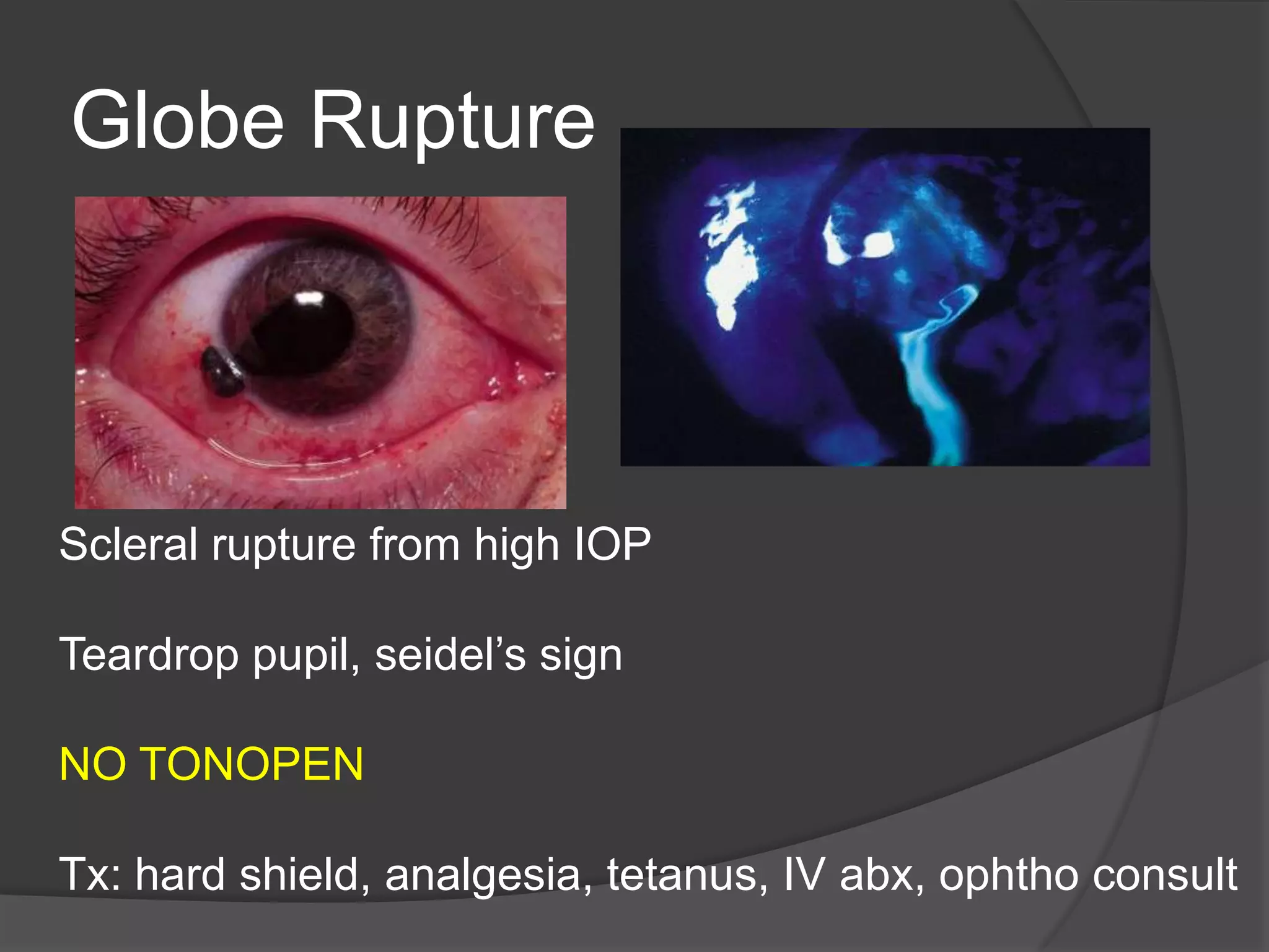 Ophthalmology Board Review- Emergency Medicine 2014 | PPTX