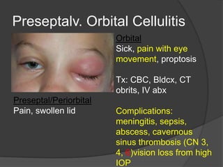 Ophthalmology Board Review- Emergency Medicine 2014 | PPTX