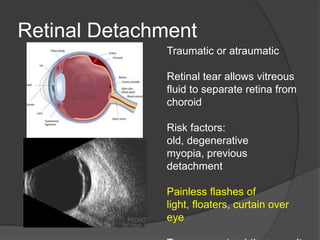 Ophthalmology Board Review- Emergency Medicine 2014 | PPTX