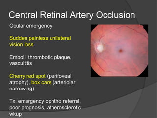 Ophthalmology Board Review- Emergency Medicine 2014 | PPTX