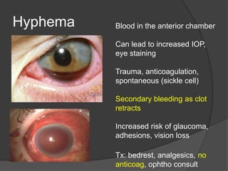 Ophthalmology Board Review- Emergency Medicine 2014 | PPTX