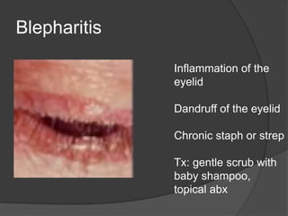 Ophthalmology Board Review- Emergency Medicine 2014 | PPTX