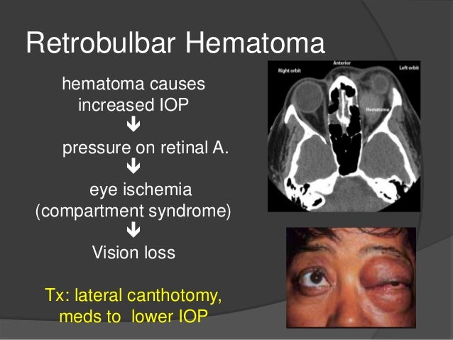 Ophthalmology Board Review- Emergency Medicine 2014