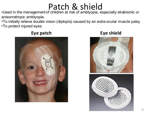 Ophthalmology ospe cc