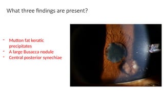 Ophthalmology Photo Quizes # 3 - Miscellaneous.pptx