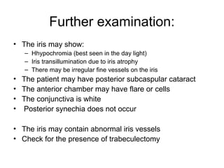 Ophthalmology quick Quiz - fuchs heterochromic cyclitis.ppt