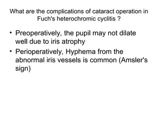 Ophthalmology quick Quiz - fuchs heterochromic cyclitis.ppt