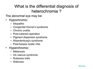 Ophthalmology quick Quiz - fuchs heterochromic cyclitis.ppt